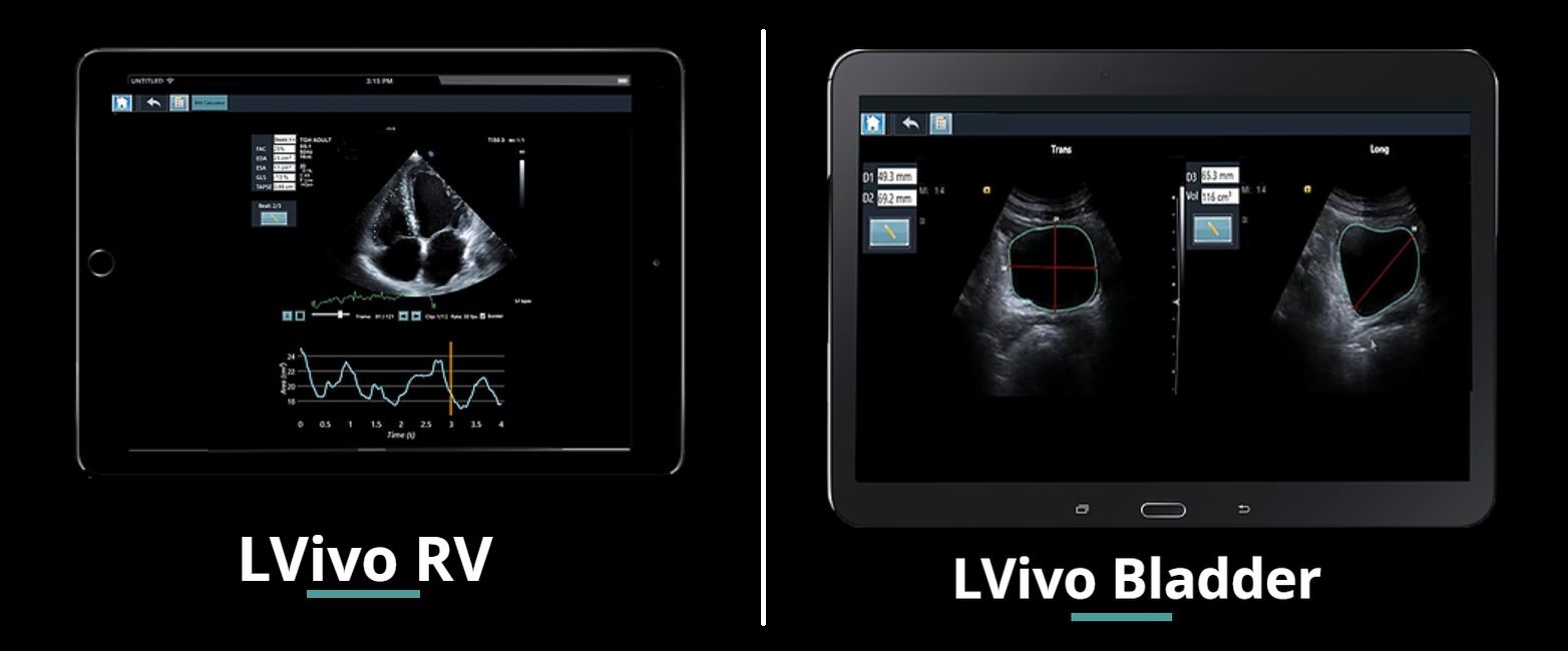 AI-Powered Ultrasound Tools for Heart and Bladder from DiA - DailyAlts